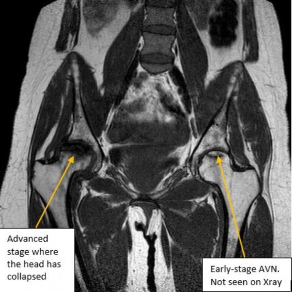 Hip Imaging and Investigations at the Hip Surgery Clinic