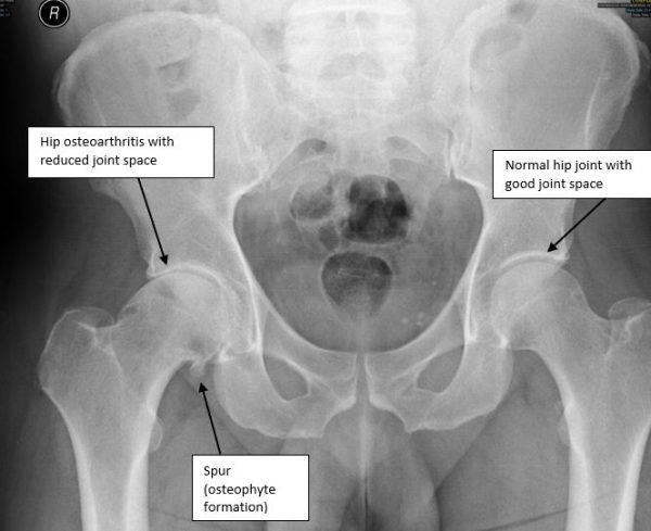 Hip Imaging and Investigations at the Hip Surgery Clinic