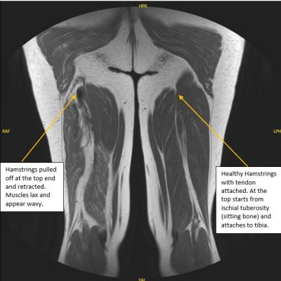 Hip Imaging and Investigations at the Hip Surgery Clinic