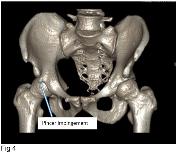 Hip Imaging and Investigations at the Hip Surgery Clinic